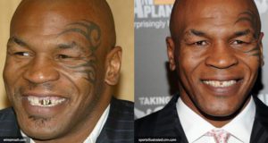 15 Celebrities Who Had To Go Through Cosmetic Dentistry & Now Have New ...